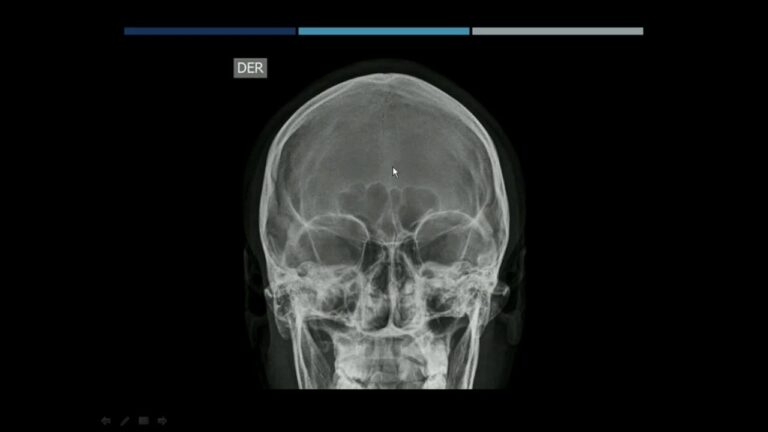 Cómo se llama la radiografía de la cabeza: Todo lo que necesitas saber ...